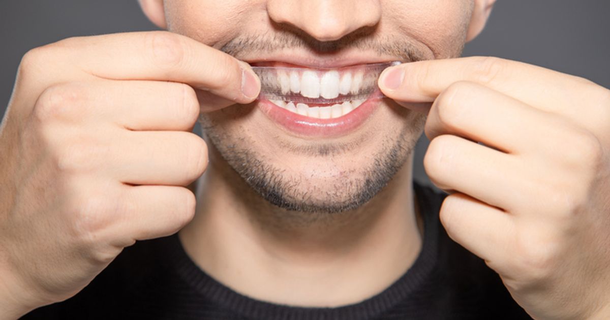 Home-Bleaching im Vergleich: Risiken, Wirkung und die besten Produkte ...